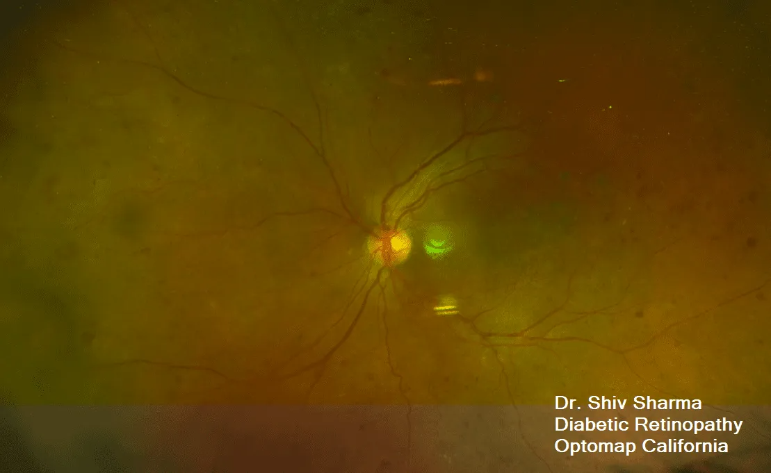 Optomap - Optiview Eye Clinic